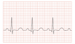 What is a Holter monitor and why does my pet need one? - Metropolitan ...