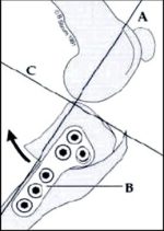CCL Injury in Dogs: A Guide to Signs, Surgery, and Recovery ...