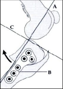 CCL Injury in Dogs: A Guide to Signs, Surgery, and Recovery ...